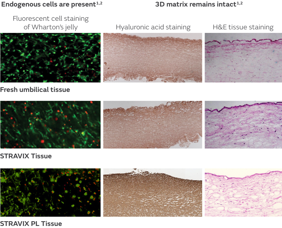 Homepage | STRAVIX PL Lyopreserved Umbilical Tissue and STRAVIX ...